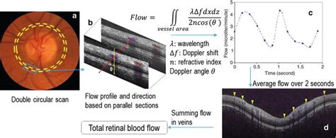 Clinical Applications Of Doppler Oct And Oct Angiography Ento Key