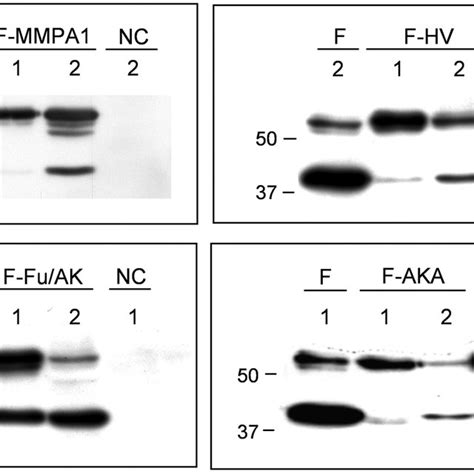 Protease Activity In Resection Material Download Table