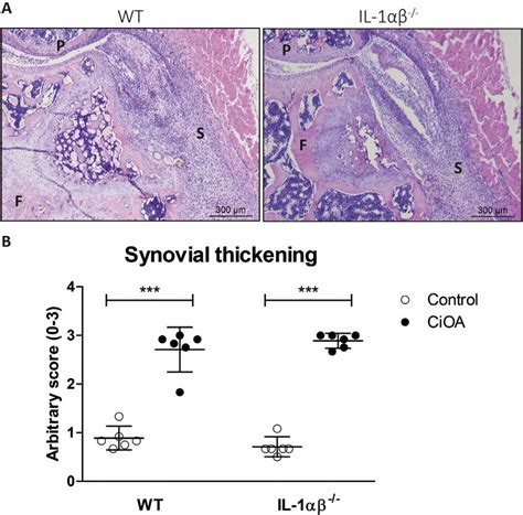 Synovial Thickening In Cioa Is Not Affected By Il 1 A Synovial