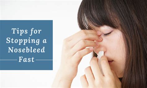 How To Stop Nose Bleeding