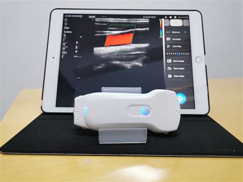 3 In 1 Linear Convex Double Probes Smartphone Usb Wifi Ultrasound Probe Portable Picc Wireless