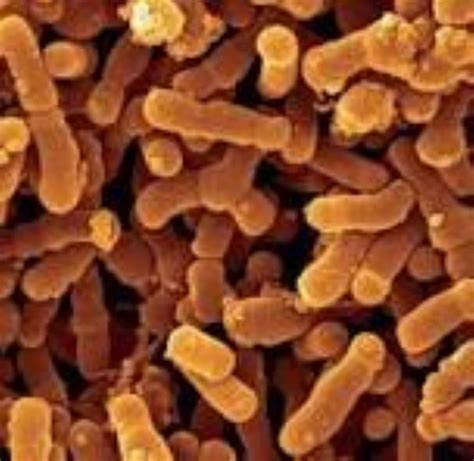 Powder Bifidobacterium Breve Packaging Type Sack Bag Packaging Size 250 Gm At Best Price