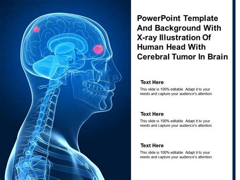 Powerpoint Template And Background With X Ray Illustration Of Human Head With Cerebral Tumor In