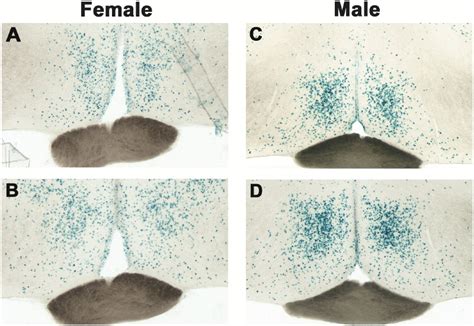 Visualizing Sexual Dimorphism In The Brain Neuron