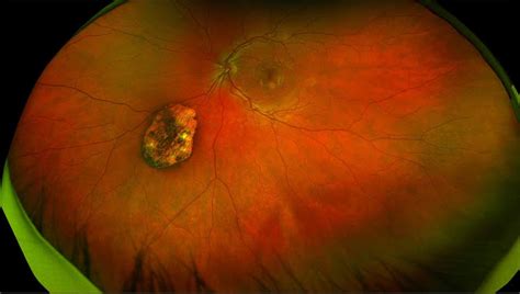 Sonoran Desert Eye Center Chrpe