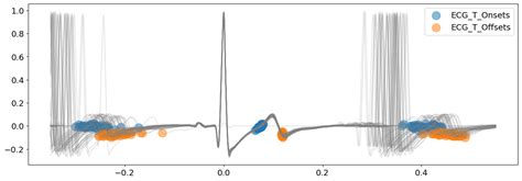 Locate P Q S And T Waves In Ecg — Neurokit2 029 Documentation
