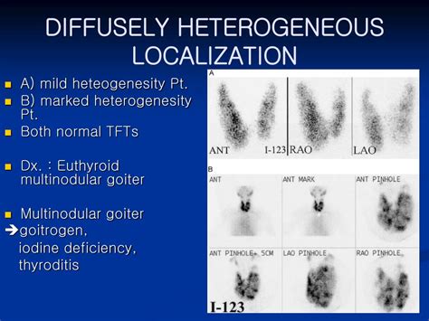 Ppt Subintern 백민관 Powerpoint Presentation Free Download Id175795