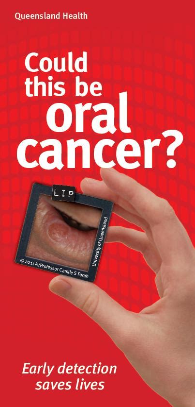 Sex Drugs Oral Cancer Brochures Fs 84 03 25 2024