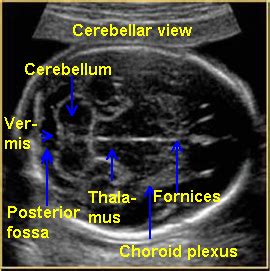 Cns Ultrasound Anatomy Brain Medical Ultrasound Ultrasound
