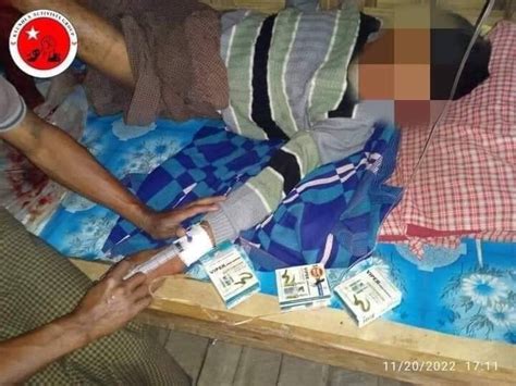 မြွေကိုက်ခံရခြင်းအန္တရာယ် နှင့် မရှိမဖြစ်မြွေဆိပ်ဖြေဆေး Ayeyarwaddy Times