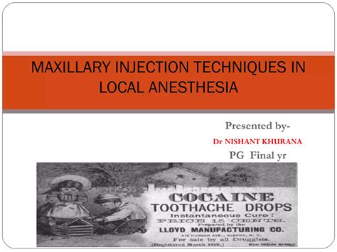 Maxillary Injection Techniques Ppt