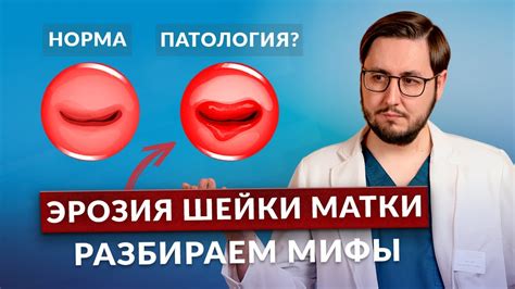 Вся правда про эрозию шейки матки которую должна знать каждая женщина Youtube