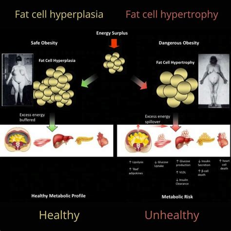Fat Loss 103 The Relevance Of Size And Number Of Fat Cells