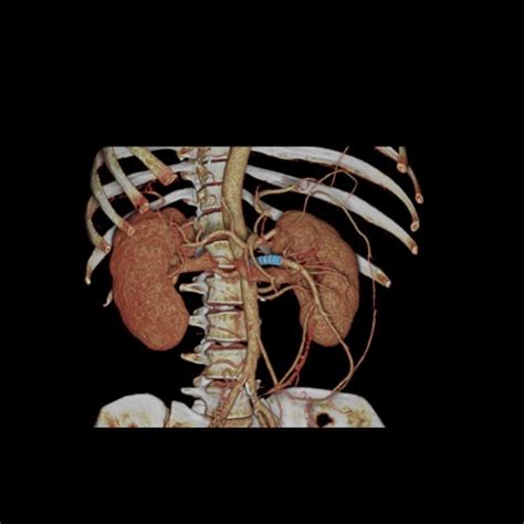 Stanford 3d And Quantitative Imaging Laboratory On Linkedin 3dimaging Interventionalradiology