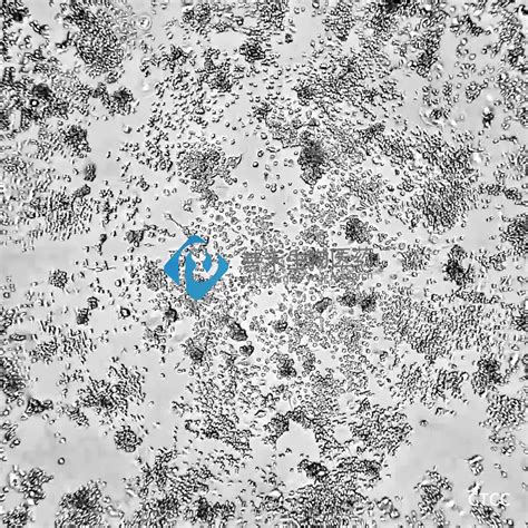 破骨诱导分化实验终极指南：raw264 7细胞株诱导的那些坑，我们帮你填平了！ 知乎
