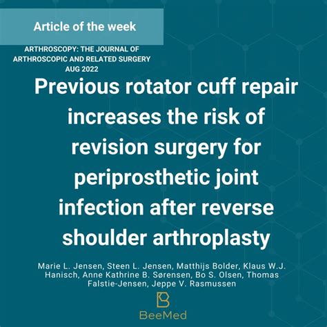 Patrick Denard Posted On Linkedin