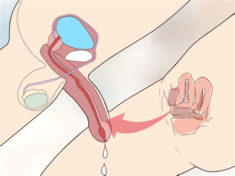 Ways To Start Birth Control WikiHow