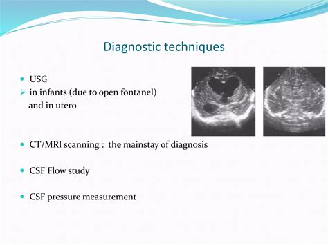 Csf Circulation Disorders Pptx