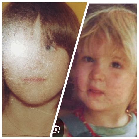 Can Someone Helpe Compare Two Pictures Feature Requests Openai Developer Community