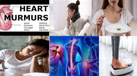 Endocarditis And Its Management Pptx Heart And Cardiovascular