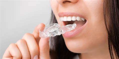 Orthodontic Retention Guide Families First Pediatrics Orthodontics