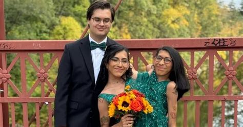 La Gemela Siamesa Carmen Andrade Celebró Su Primer Aniversario De Boda Con Daniel Mccormack