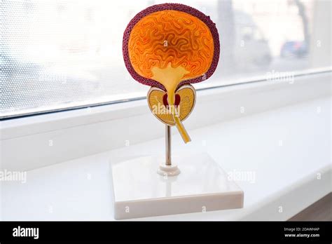 Plastic Bladder In The Doctors Office Visual Material For The