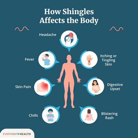 Shingles Symptoms Tips For Treating And Preventing Shingles Your