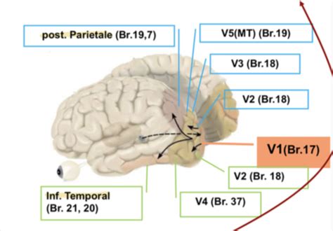 3 4 Agnosias And Comparison Of Lesion Of Dorsal And Ventral Visual