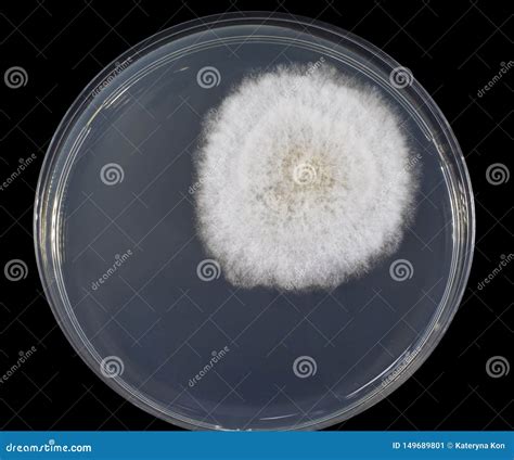Spherical Colony Of Cyanobacteria Gleotrichia Blue Green Algae Stock