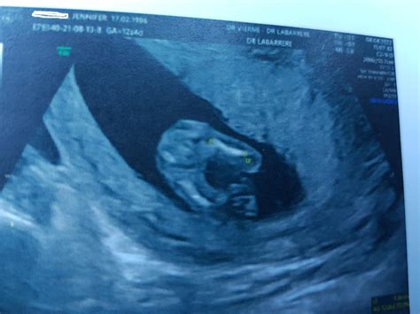 Echo T1 Fille Ou Garçon