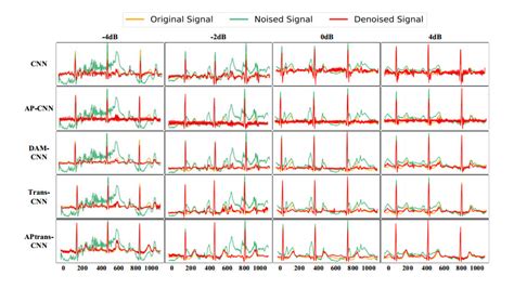 Convolutional Transformer Driven Robust Electrocardiogram Signal Denoising Framework With