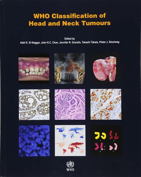 Buy Who Classification Of Head And Neck Tumours World Organization