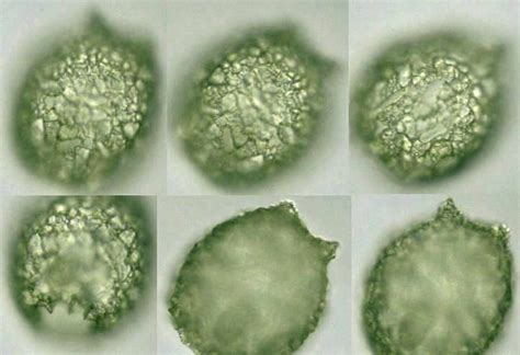 Protist Images Difflugia Corona