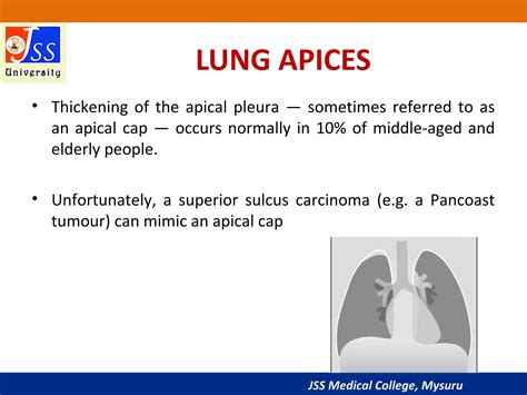 Approach To Chest X Ray And Interpretation Ppt