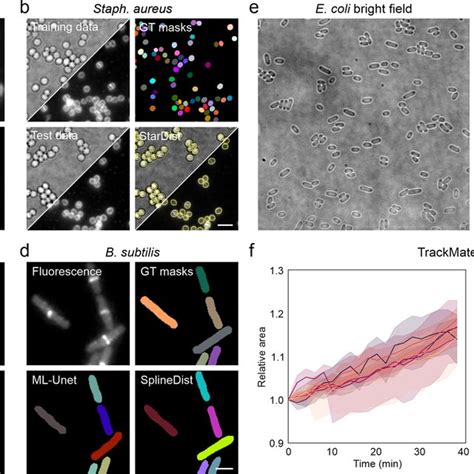 Segmentation Of Bacterial Images Using Open Source Deep Learning
