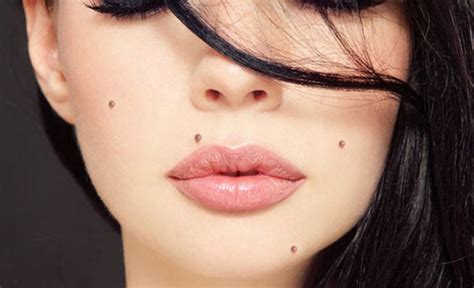 ホクロ取りにてキレイになろう 韓国美容クリニックABIJOU CLINICオフィシャル