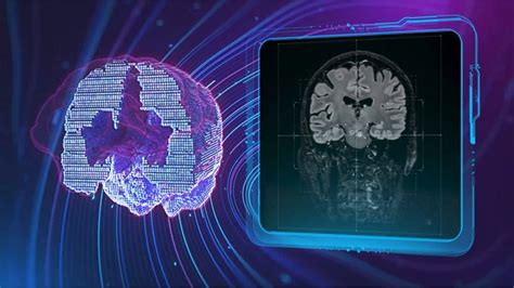 Susan Mathew Posted On Linkedin