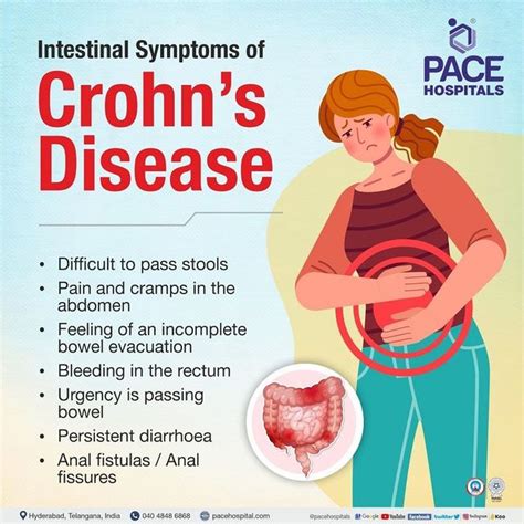 Crohns Disease Brochure Crohns Disease Diagnosis And Management