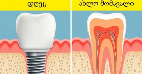 მეცნერების ახალი აღმოჩნეა კბილი 2 კვირაში თავიდან აღმოცენდება