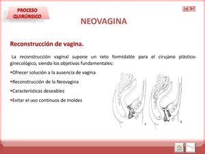 Calaméo Neovagina