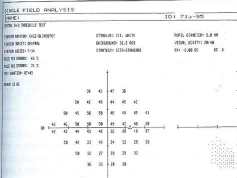 Automated Perimetry Ppt