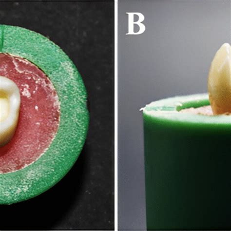 Tooth Preparation A Occlusal View B Proximal View Download Scientific