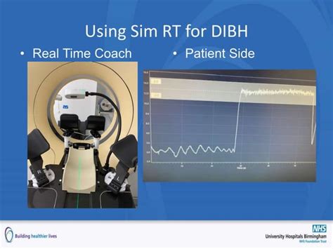 Simrt Workflows And Optimizing Dibh Planning Pptx