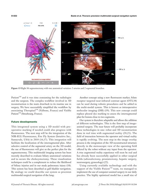 Study Development Of A Precision Multimodal Surgical Navigation System
