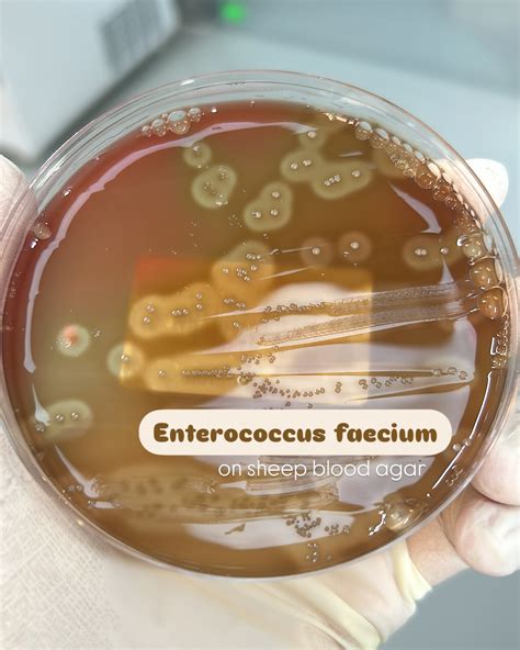 Xətayə M Quliyeva Microbiologist Md Enterococcus Faecium Isolated Urine Culture🧫