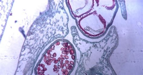 What Is Microsporogenesis Askcorran