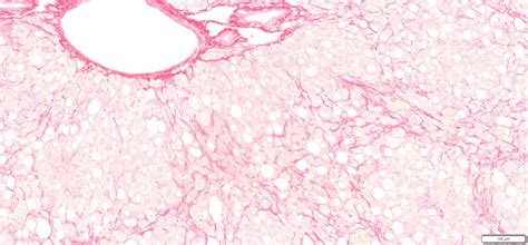 Positive Control Ffpe Slides For In Situ Collagen Detection