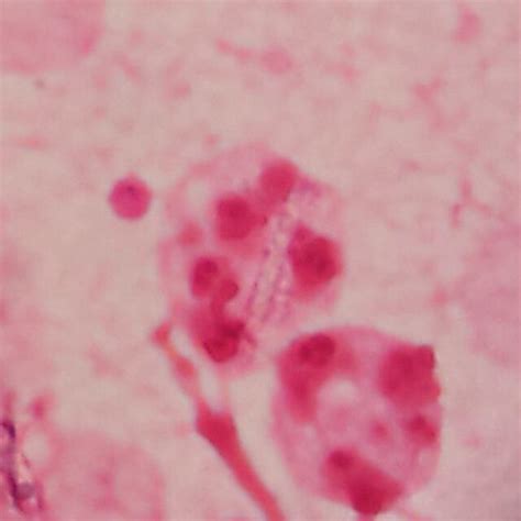 Gram Stain Shows Calcium Pyrophosphate Crystals Phagocyted By Download Scientific Diagram