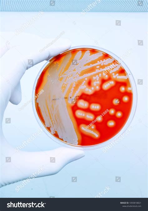 Beta Hemolysis Staphylococcus Aureus On Sheep 스톡 사진 1093818821 Shutterstock